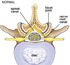 Pars Fracture (Spondylolysis) – Meet Dr. Joel Edionwe